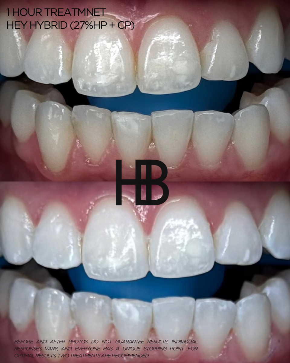 Hey Bright Teeth Whitening